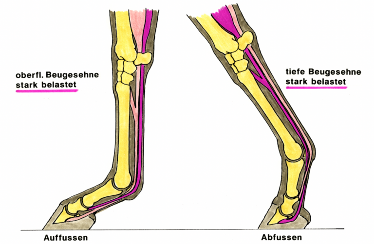 Zerrungen und Entzündungen von Sehnen (Tendinitis) | Universitäres ...
