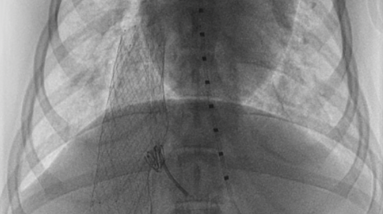Neues aus der Kardiologie: Eingriff IHPSS | Universitäres Tierspital Zürich
